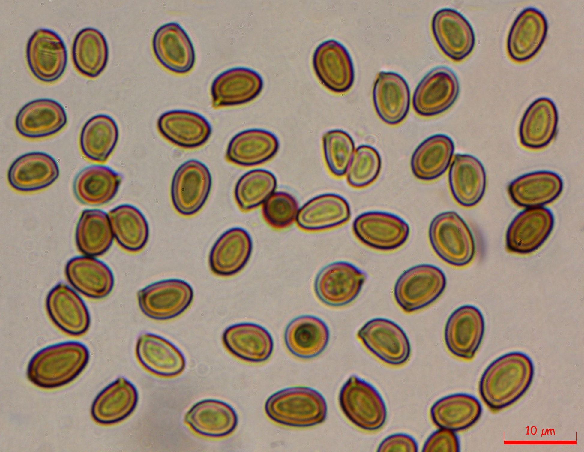 Les spores de champignons sont-elles des graines de champignons ...